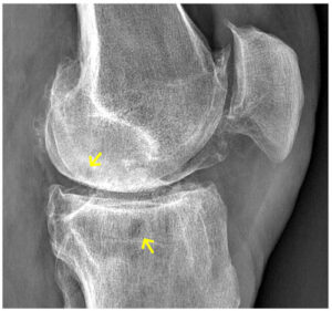 Focused Topic: MSK – GEST