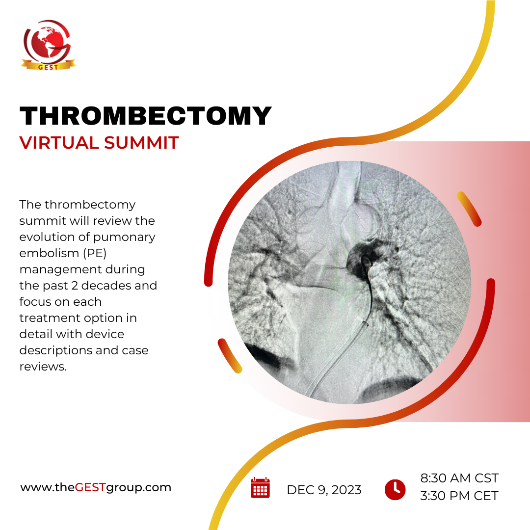 Virtual Thrombectomy Summit – GEST