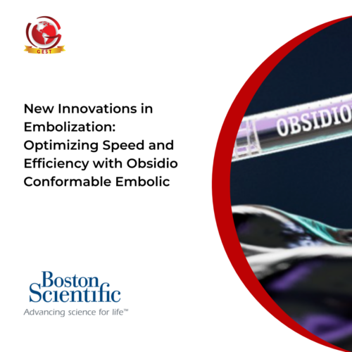 New Innovations in Embolization: Optimizing Speed and Efficiency with ...